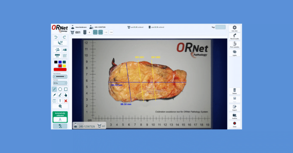ORNet Pathology A New Standard for Efficiency in Pathology Labs – ORNet