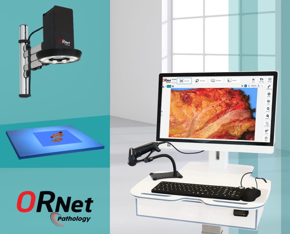 Gross Pathology: An In-depth Overview – ORNet